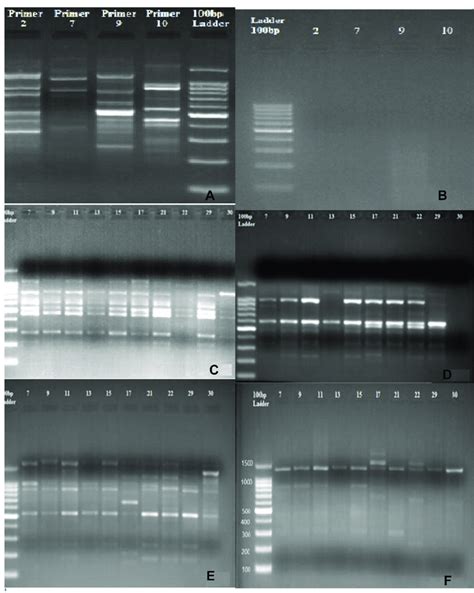 Rapd Pcr Patterns Produced From The Genomic Dna Of Schistosoma