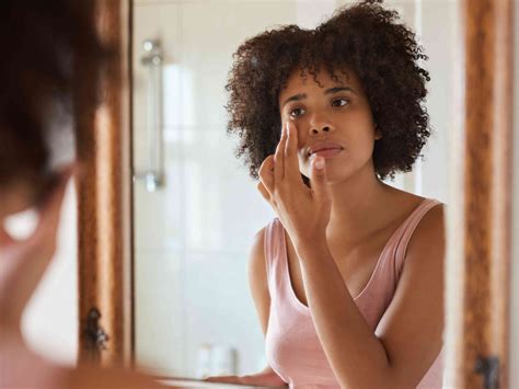 How To Get Rid Of A Scab From A Pimple According To Dermatologists