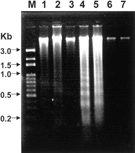 Representative Results Of Agarose Gel Electrophoresis Of Genomic Dna