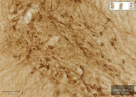 Neurons Count Dab Staining Image Analysis Imagesc Forum