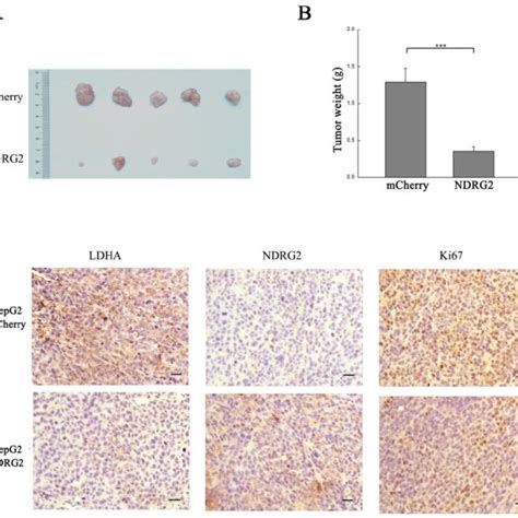 NDRG2 Inhibits The Malignant Growth And Proliferation Of HCC Cells A