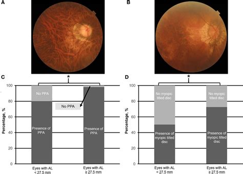Top Panels Ab Are The Representative Fundus Photographs Of