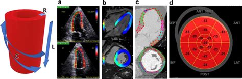 Cardiac Deformation Imaging With Different Modalities In An Example Of Download Scientific