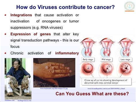Virus And Cancer