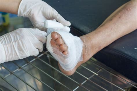 Stitches Healing Stages Key Insights For A Smooth Recovery