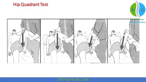 Hip Quadrant Test Explained Easily Orthofixar