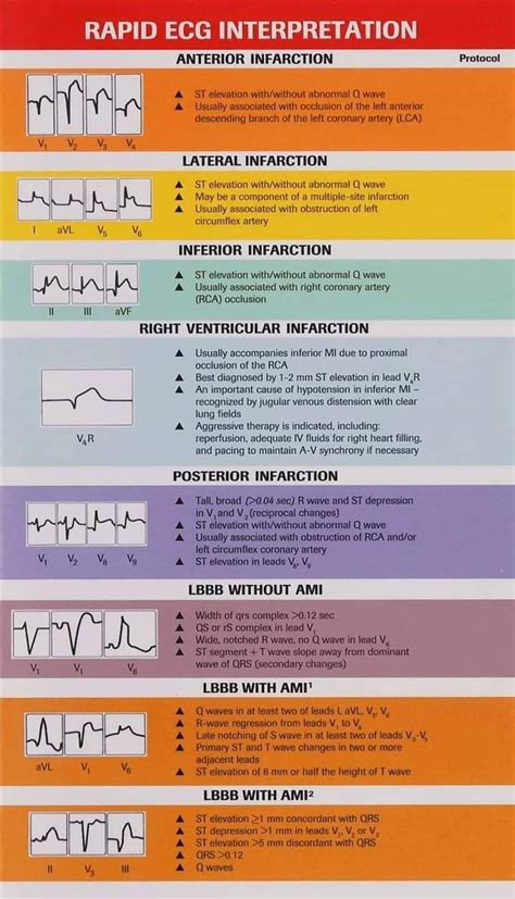 Abnormal Ecg Interpretation