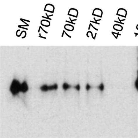 70 Kd Affinity Chromatography Of Purified α5β1 Integrins Purified α5β1 Download Scientific