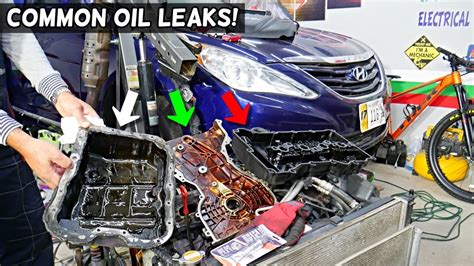 Hyundai Sonata Oil Leak Fix Most Common Oil Leaks Youtube