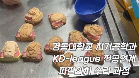 경동대학교 치기공학과 KD league 전공연계 파절의치 수리 YouTube