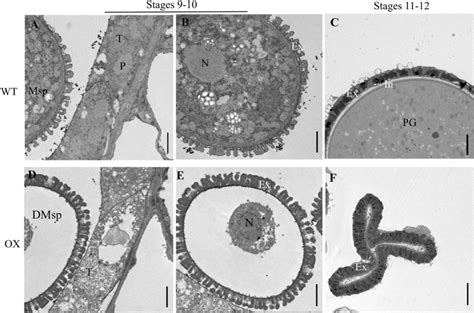 Transmission Electron Micrographs Tem Observation Of The Download Scientific Diagram
