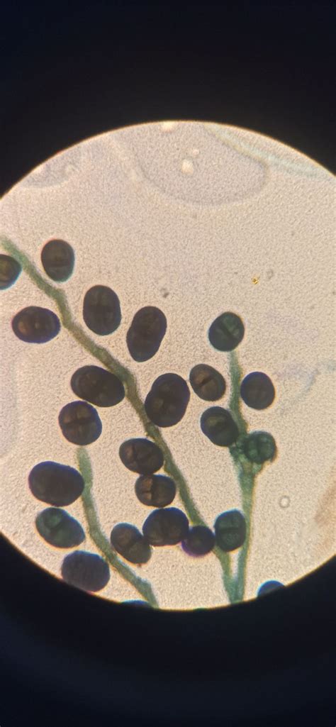 Amel Bennacer On Linkedin Ulocladium Sp Aspergillus Terreus Fusarium