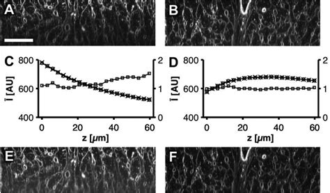 Measuring And Correcting Depth Dependent Attenuation Cross Sectional Download Scientific