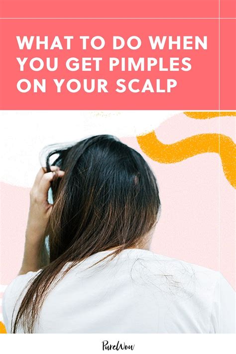 We Ask A Derm What Can I Do About These Pimples On My Scalp Artofit