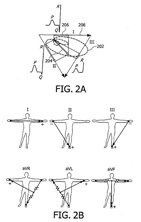 Fetal Monitoring Patented Technology Retrieval Search Results Eureka