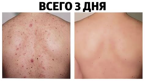 Как выглядят метастазы фото на коже человека
