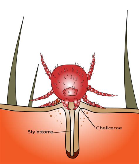How To Get Rid Of Chigger Bugs Naturally Bugwiz