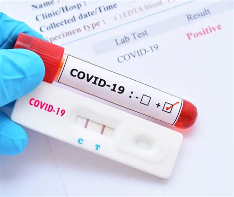 Le Nuove Regole Per Uscire Dallisolamento Da Covid