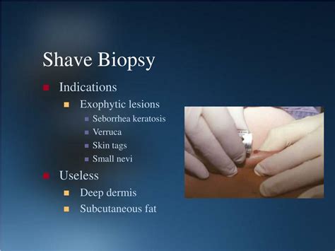 Ppt Dermatological Assessment And Procedures Powerpoint Presentation