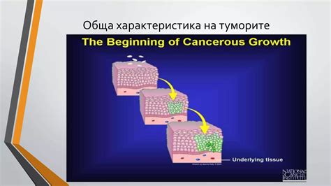 тумори обща характеристика Pptx