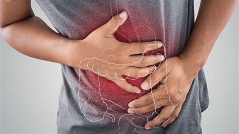 8 Symptoms Of Hernia Page 4 Entirely Health