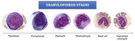 Immature Granulocyte Horiba Medical