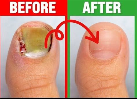3 Minute Shower Hack Flushes Away Fungus In Record Time By