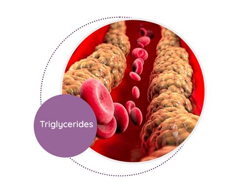 Triglycerides Mediscan Lab