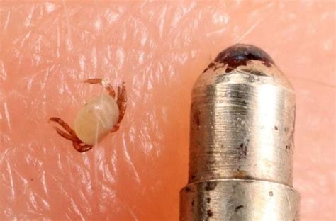 Mokslininkas Ugis Piterans Latvijoje Pasirodė Skaidrios Erkės