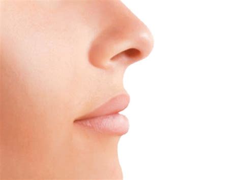 Permanent Non Surgical Nose Job Deviated Septum Information Advice