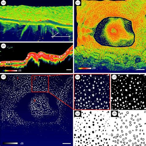 Imaging And Segmentation Of GFP Containing Chromatophore System A