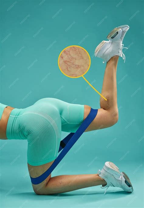 Free Photo Blood Clots In Legs Collage Design