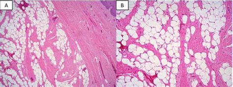 Hard Palate Histology