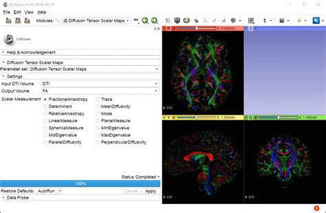 Dti教程05 弥散张量的标量测量 Dti 3dslicer中文论坛