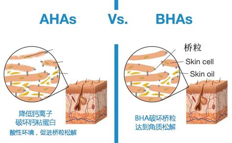 α羟基酸（果酸） Vs β羟基酸（水杨酸） Medscicn