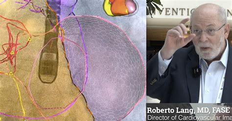 Echo Labs Not Using Ai Will Be Left Behind