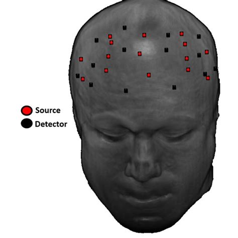 Illustration Of The Source Detector Sd Positions Co Registered Onto A
