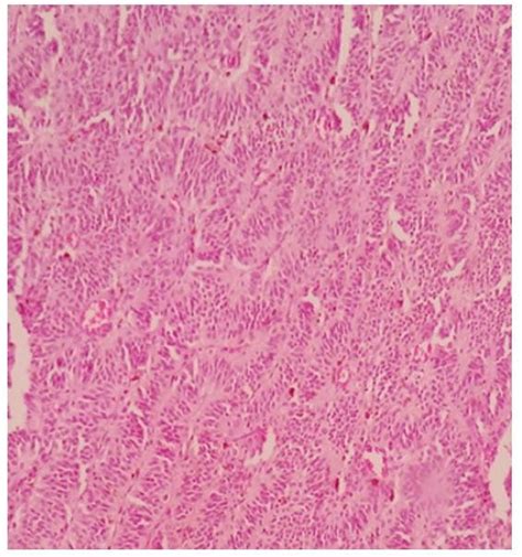 Low Power Hematoxylin Eosin Staining Slide × 10 Download Scientific