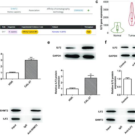 Shmt2 Is Up Regulated In Oscc Cells A B The Detection Of Shmt2 Mrna