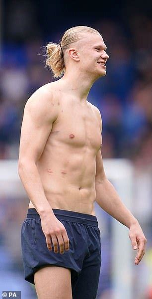Manchester City Shirtless Erling Haaland Shows Off Battle Scars From