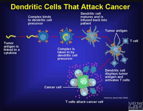 Dendritic Cell Therapy And Supporting Strategies Cancer Treatments