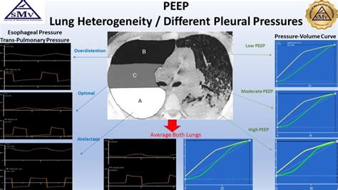 One Reason Why There Is Nothing Called Best Peep And Why Vili Is