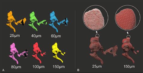 Image A Shows 3d Reconstruction Of The Ossicular Chain With Reducing Download Scientific