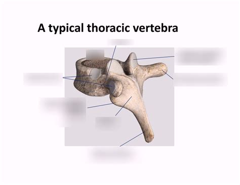 Diagram Of Mss Typical Thoracic Vertebra Quizlet