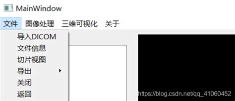 医学影像三维重建系统的设计与实现 Csdn博客