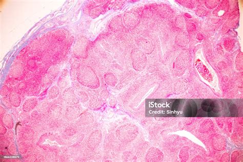 Histological Tonsil And Parotid Human Cells Under Microscope Stock