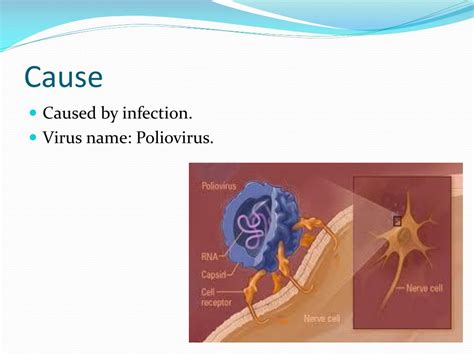 Ppt Poliomyelitis Powerpoint Presentation Free Download Id5557592