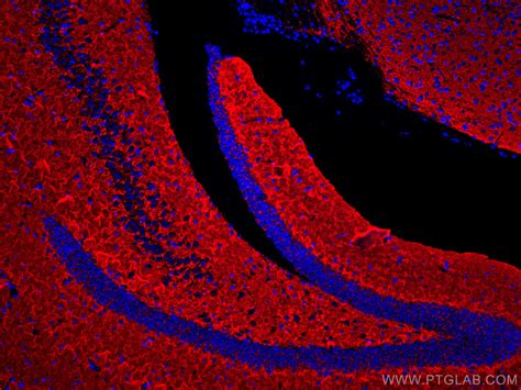 Synaptophysin Antibody Cl594 67864 Proteintech