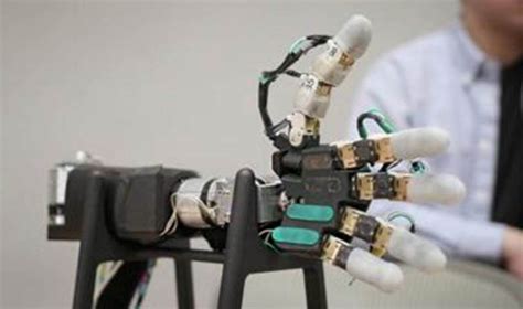 Revolutionizing Prosthetics The Ai Powered Bionic Arm