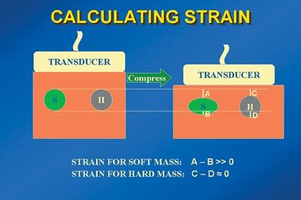 Tissue Elasticity Imaging Using Ultrasound Applied Radiology